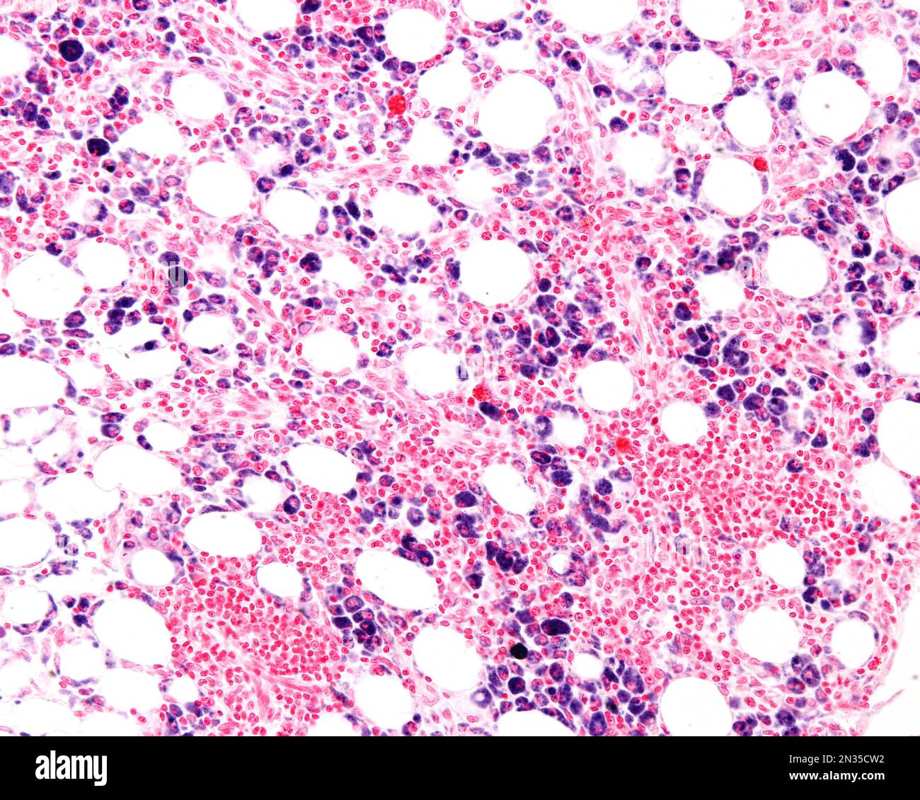 Macrophages of an inflammation zone heavily marked with Trypan blue a ...