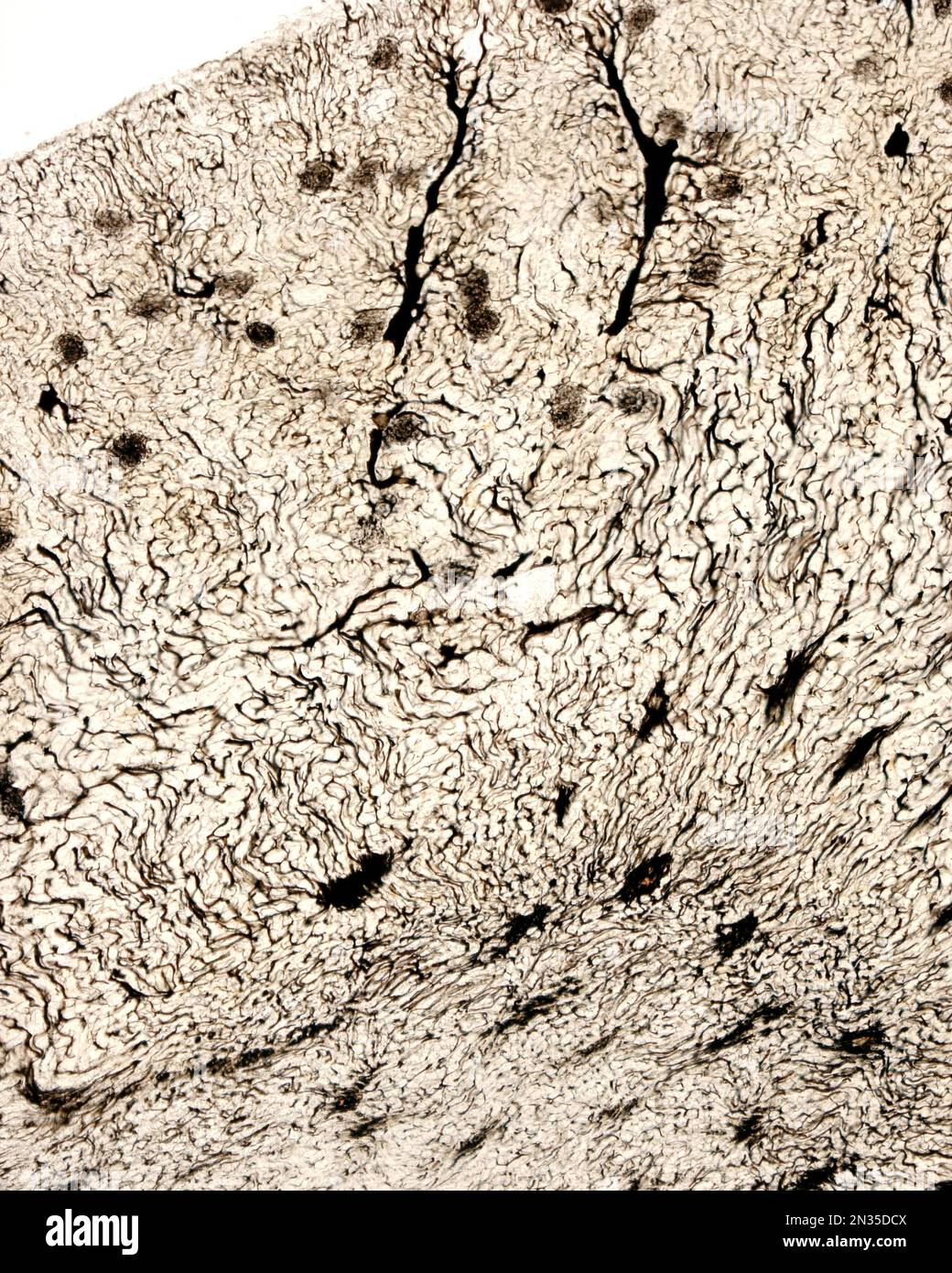 The study of an organ microvasculature usually implies the filling of ...