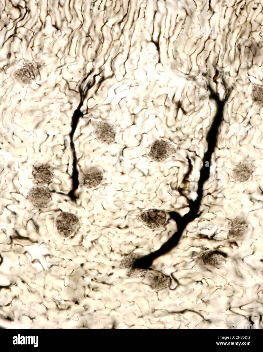 The study of an organ microvasculature usually implies the filling of ...