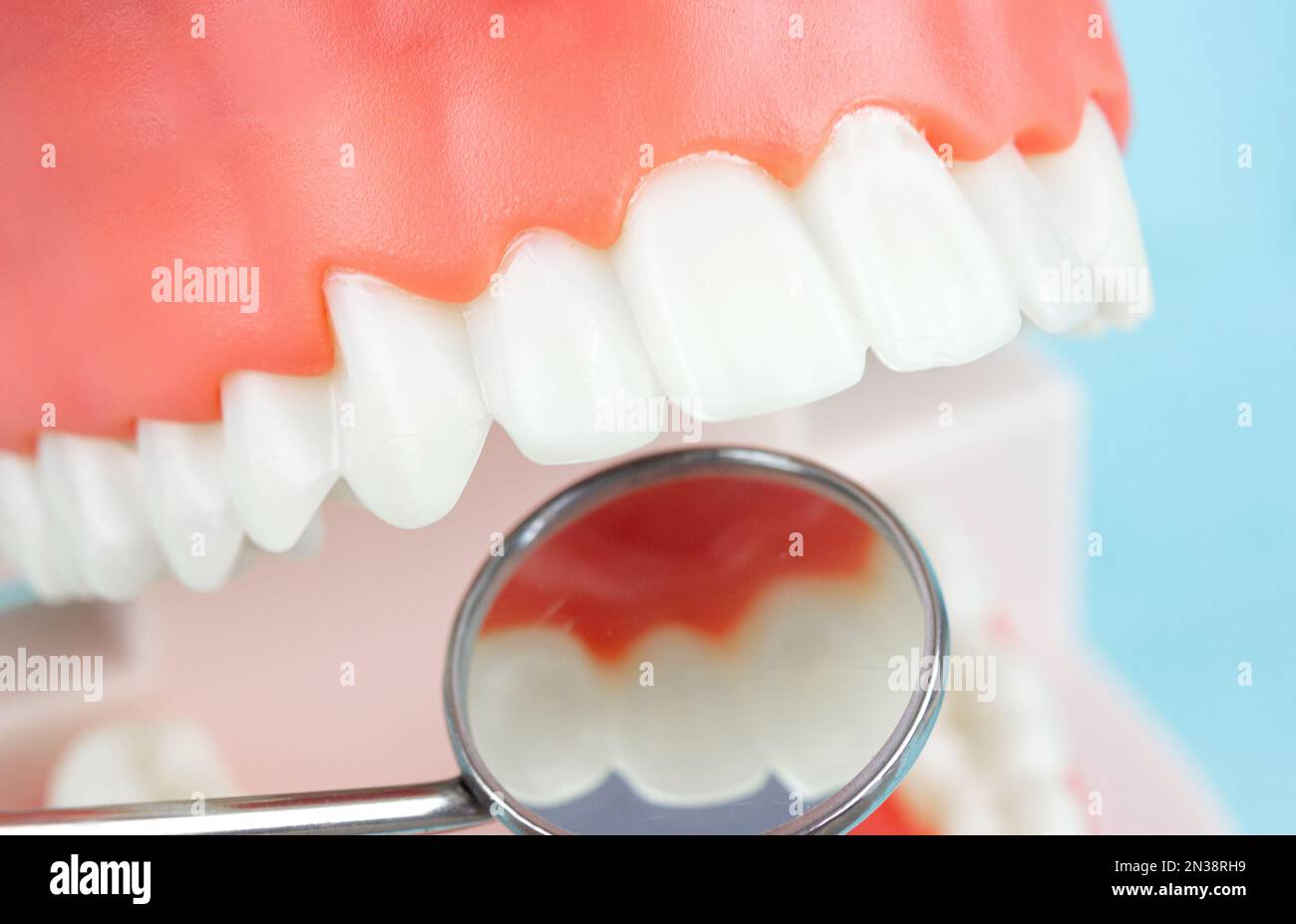 Dentistry conceptual photo. Close-up individual tooth tray Orthodontic ...