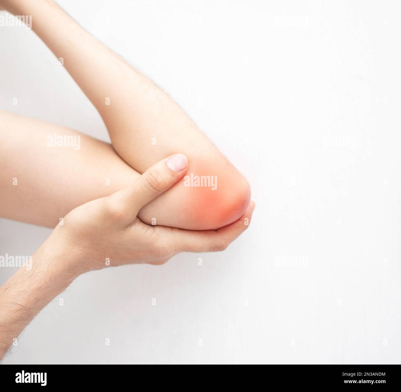 A hand holding an arm with a burning red sore elbow on a white ...