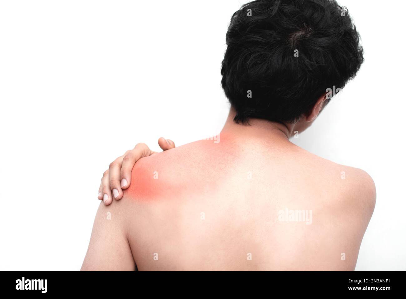 A male holding his back with a burning red sore shoulder on a white ...