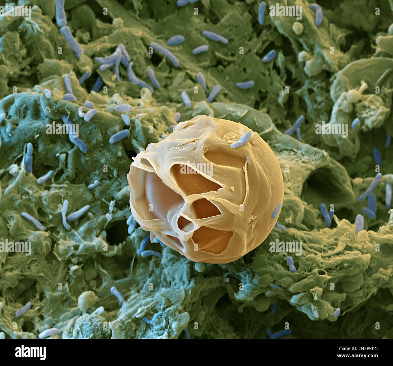 Dormant golden-brown alga, SEM Stock Photo - Alamy
