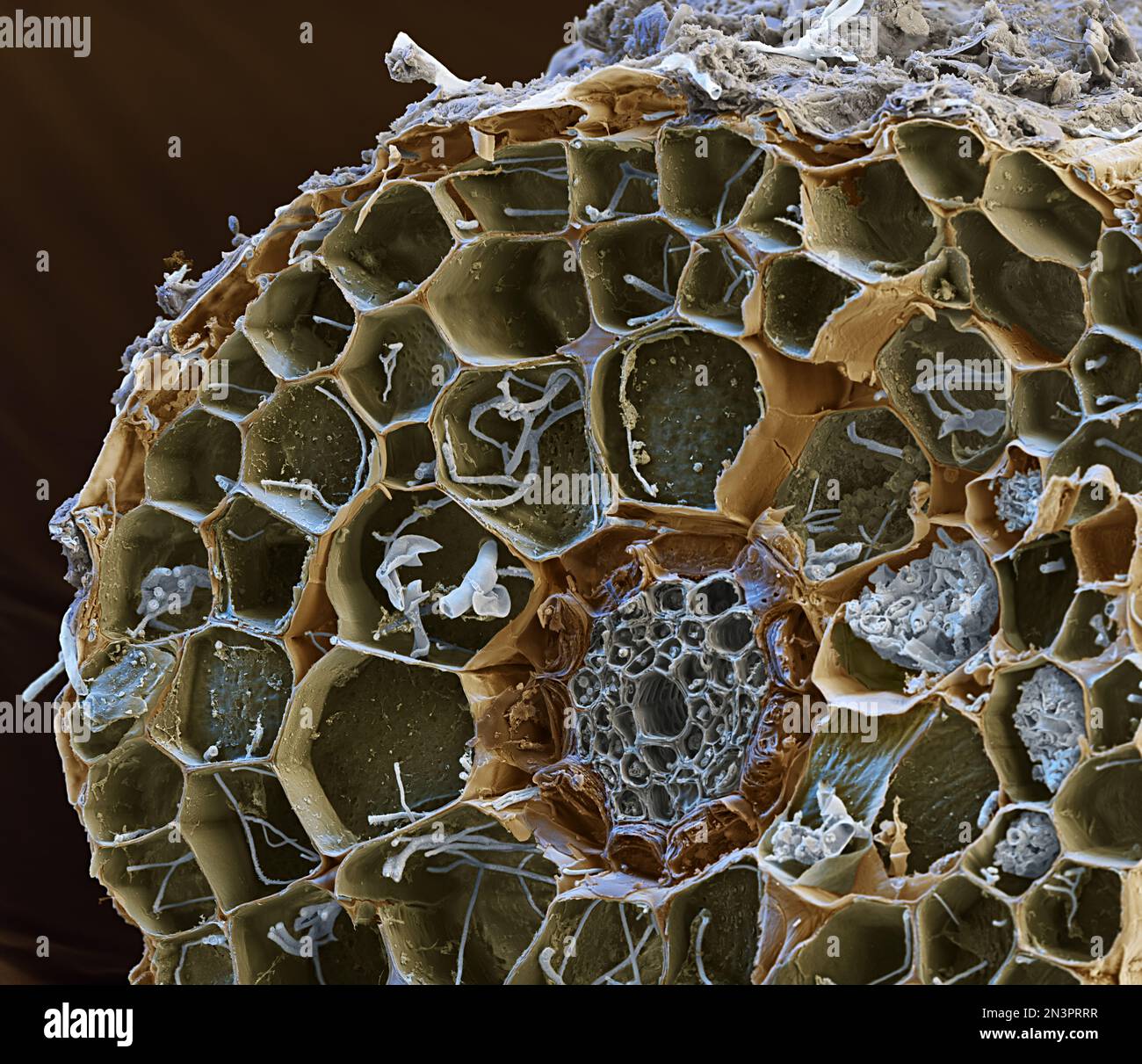 Plant root with endomycorrhiza, SEM Stock Photo - Alamy