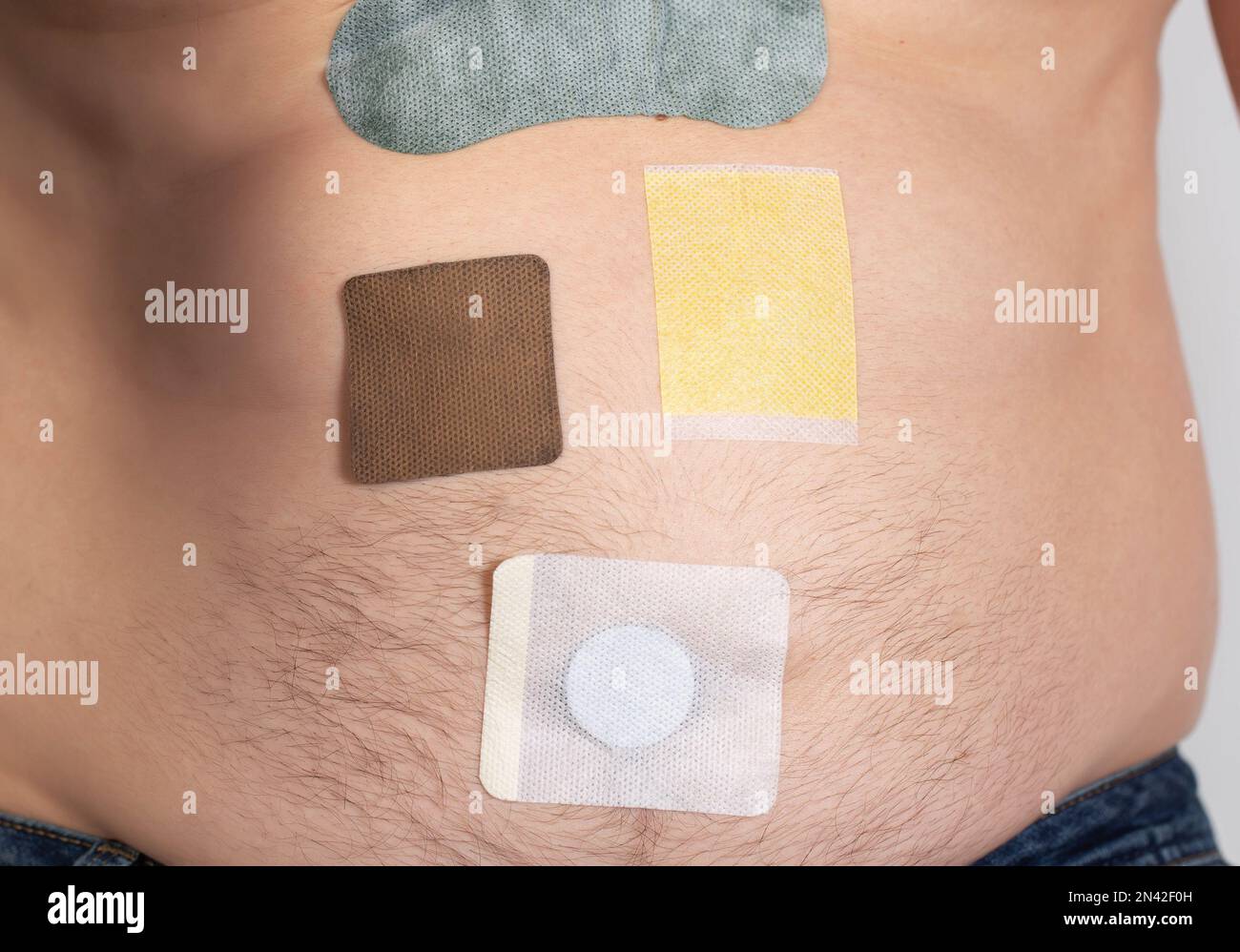 Various medical plasters are glued on the human body. Plaster from ...