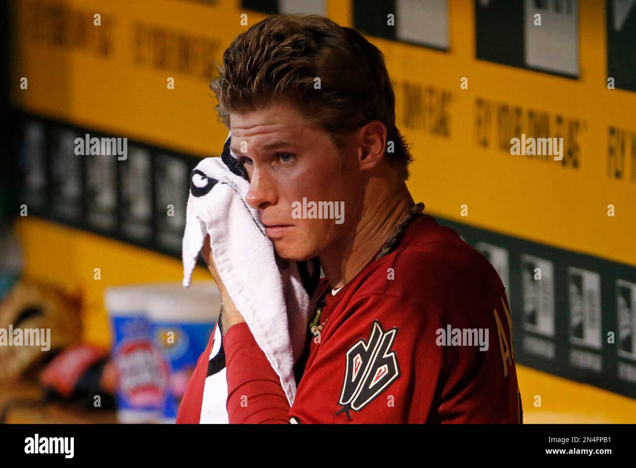 Arizona Diamondbacks starting pitcher Chase Anderson wipes his face in ...