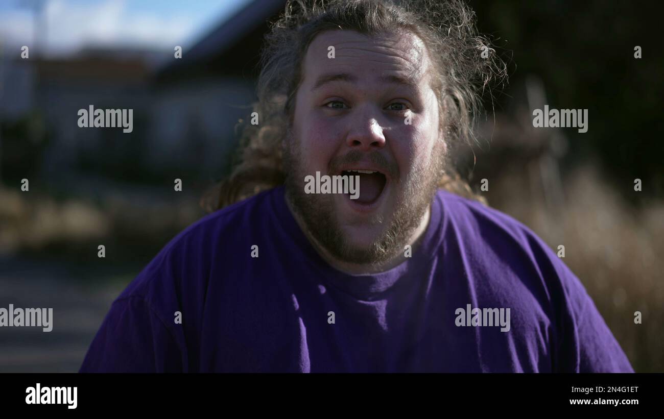 Happy young man WOW reaction standing outdoors looking at camera. Close ...