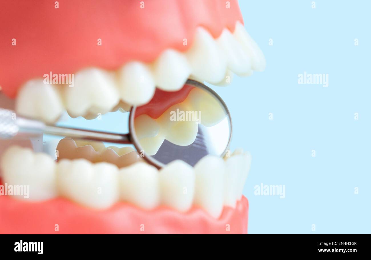Dentistry conceptual photo. Close-up individual tooth tray Orthodontic ...