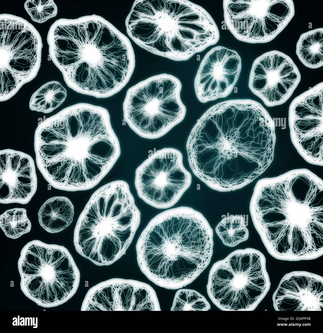 Sepsis illustration hi-res stock photography and images - Alamy