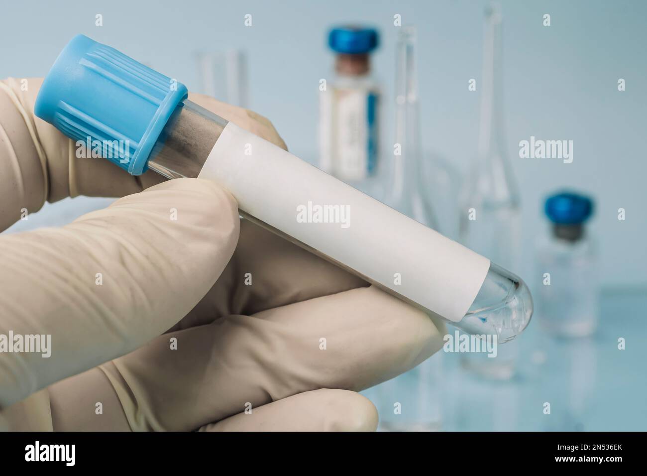 Test tube with empty label to biological sample for medical laboratory ...