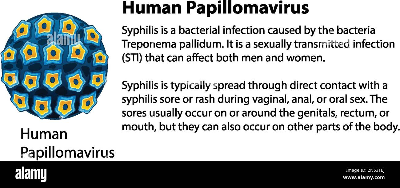 Human Papillomavirus with explanation illustration Stock Vector Image ...