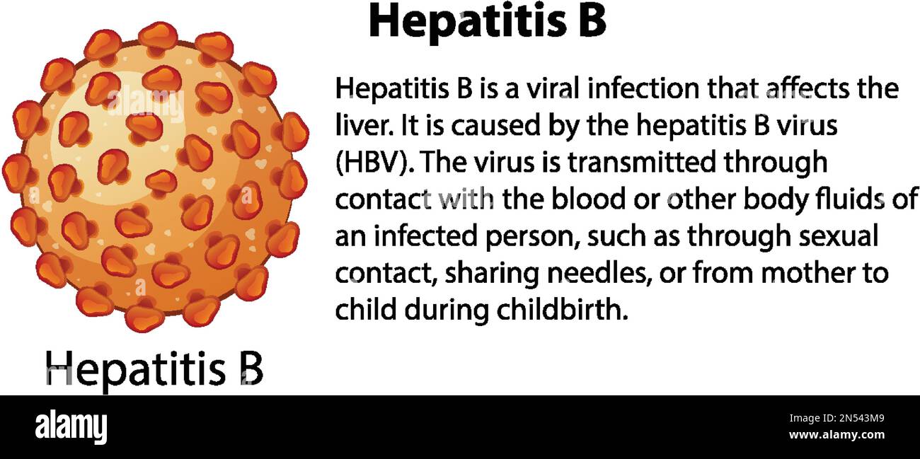 Hepatitis B with explanation illustration Stock Vector Image & Art - Alamy