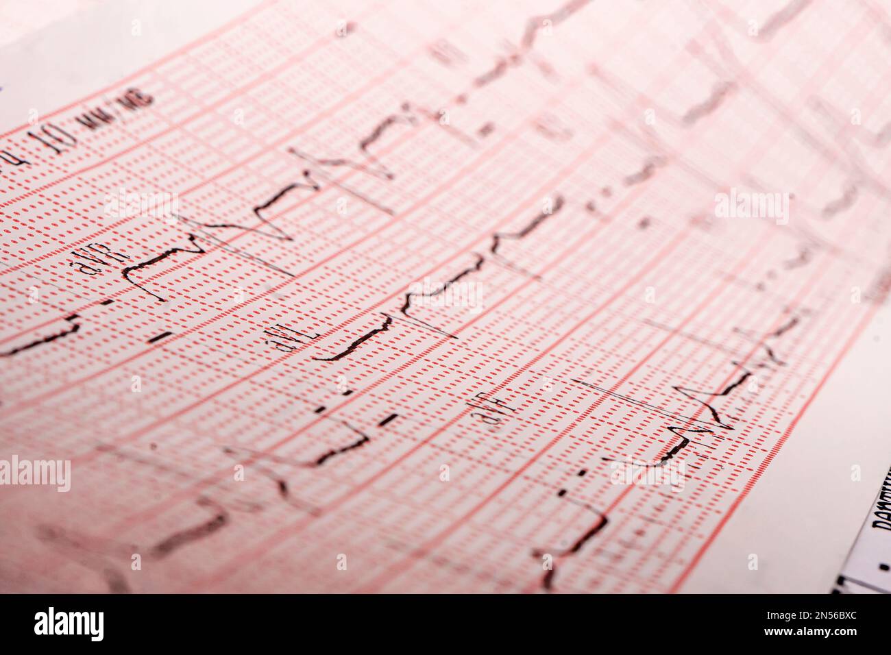 Close up of ECG, electrocardiogram. The work of a healthy heart on ...