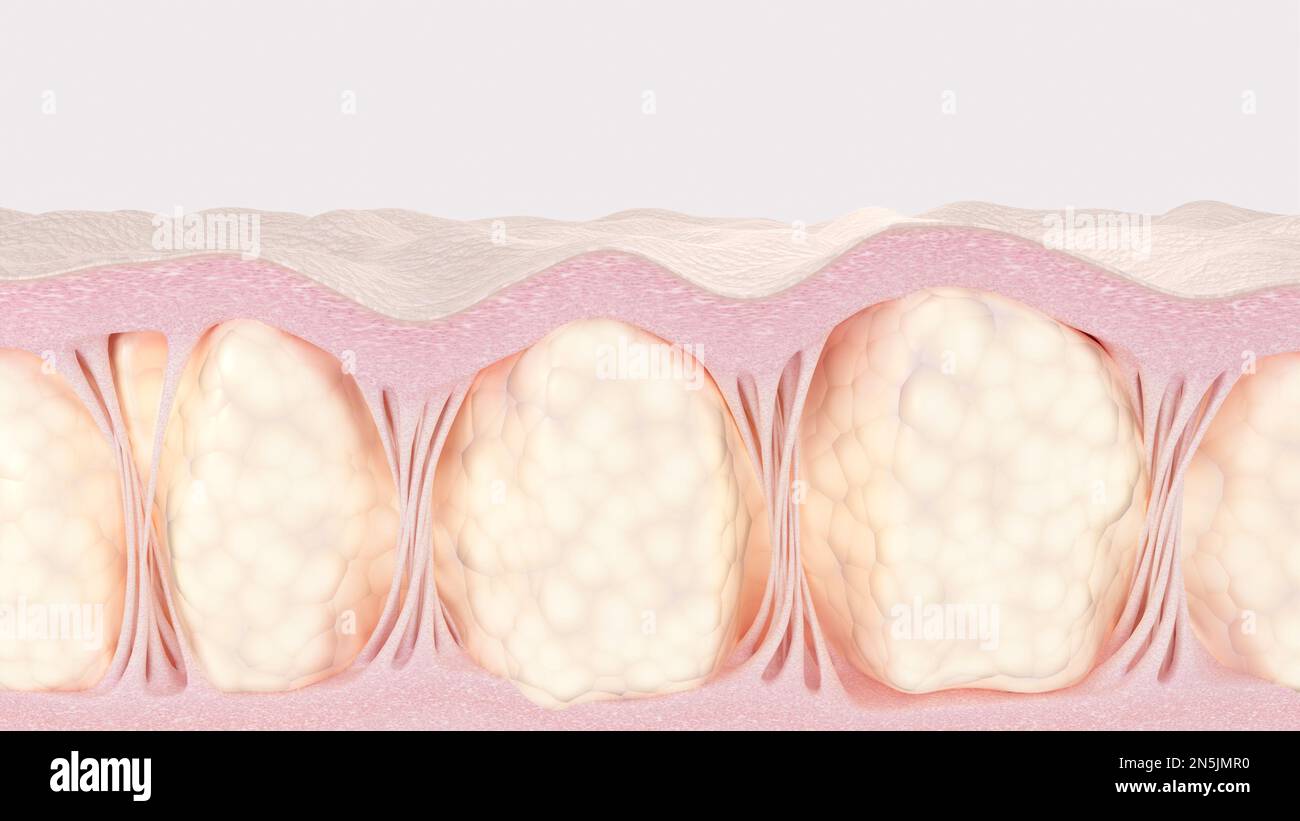 Cellulite skin cross-section. Adipose cells and connective tissue 3d ...