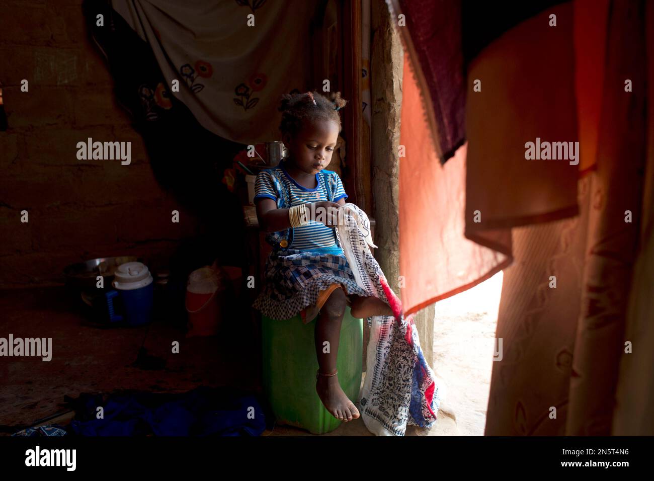 In this Oct. 10, 2013 photo, Four-year-old Fatou Ba, who was born with ...
