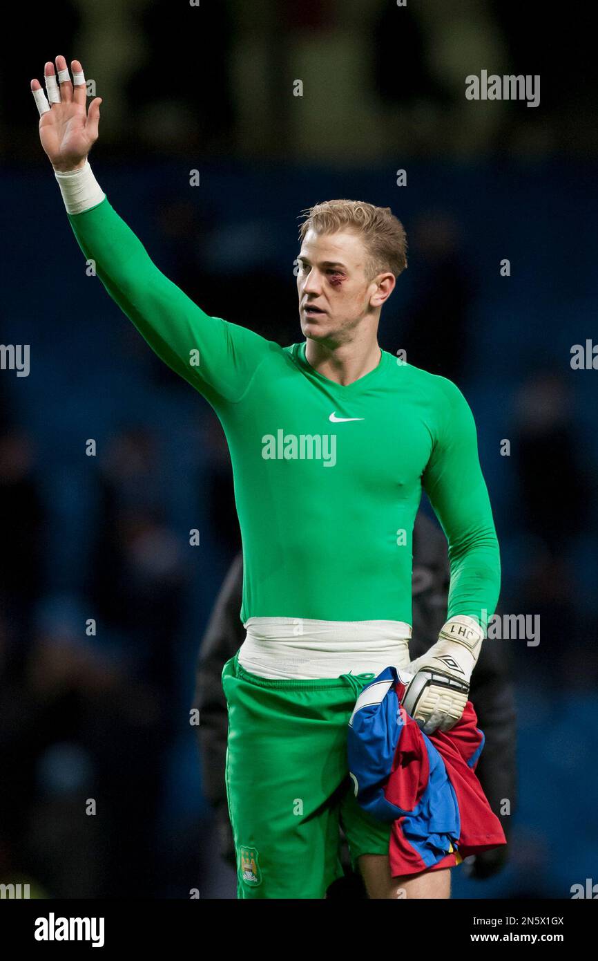 Joe Hart Eye