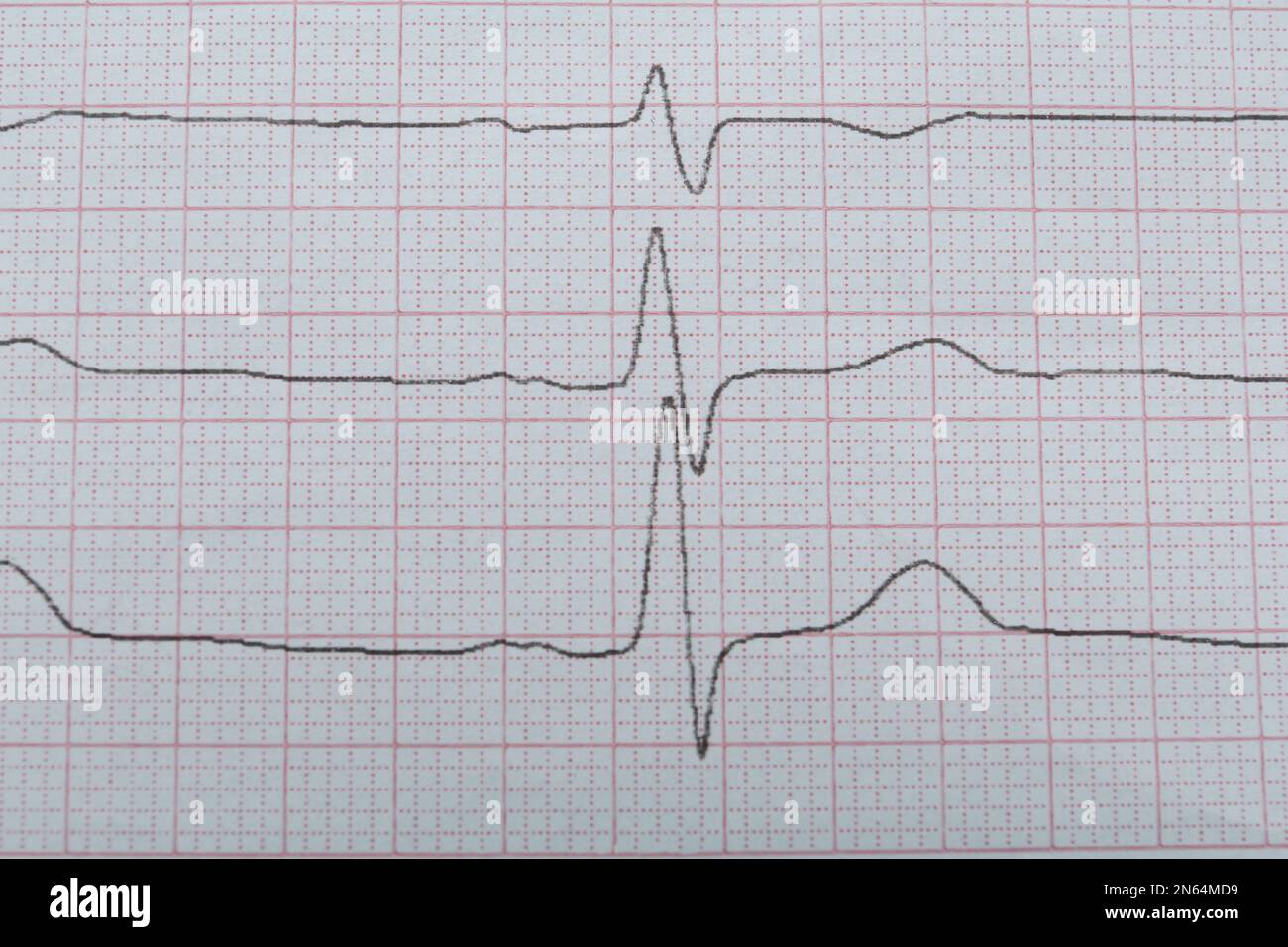 Vector heart cardiogram hi-res stock photography and images - Alamy