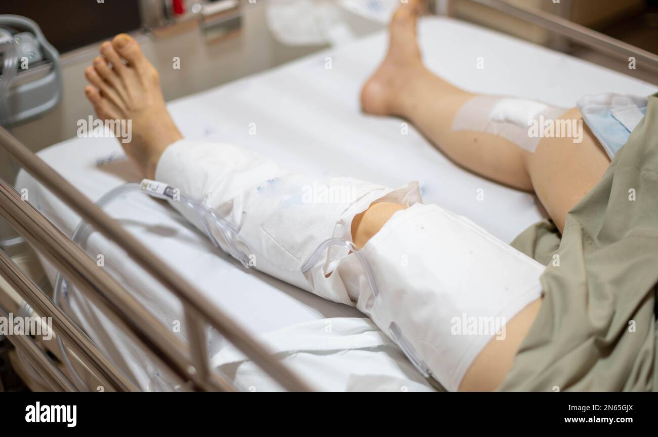 The old lady woman patient shows her scars from surgical wound surgery ...