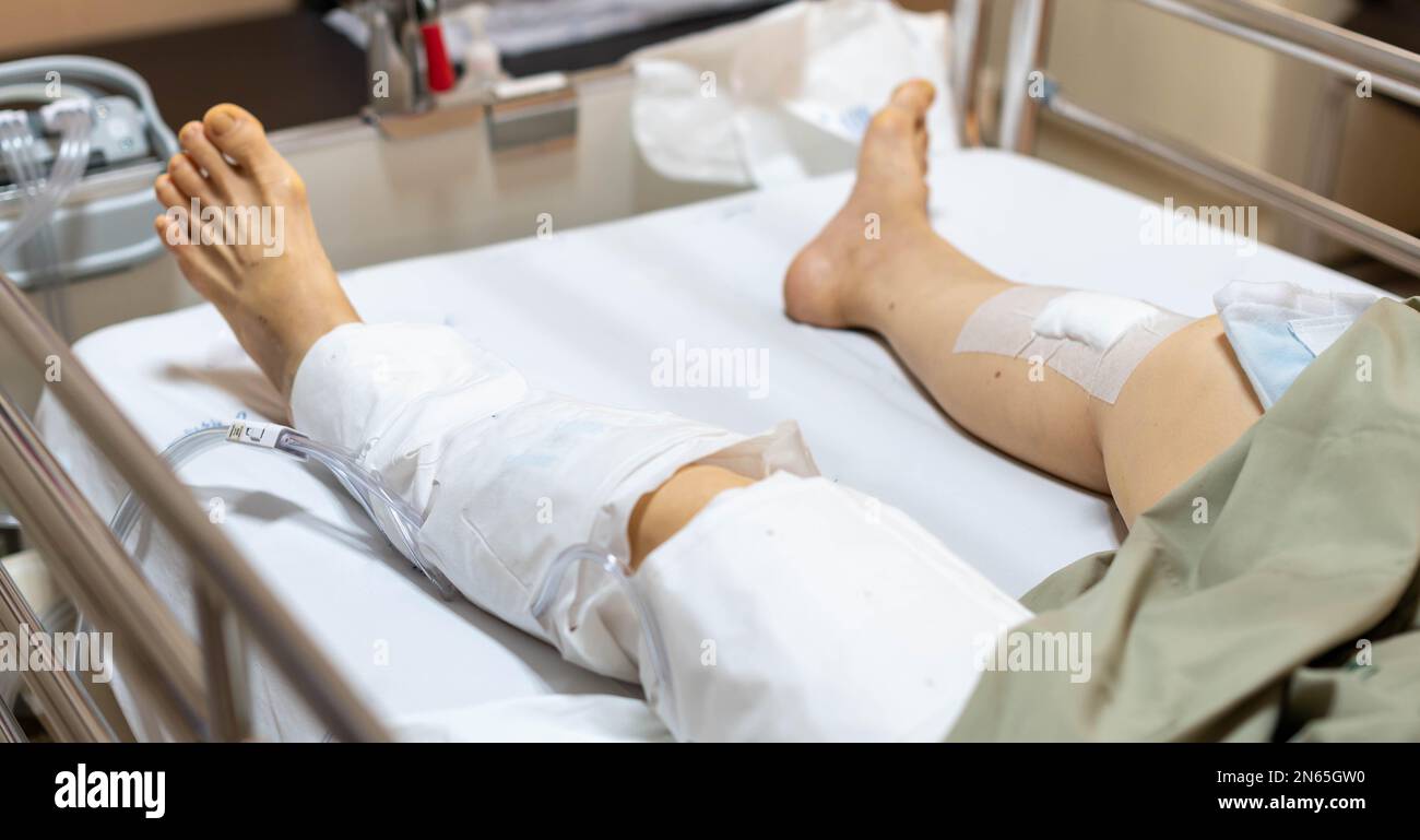 The old lady woman patient shows her scars from surgical wound surgery ...