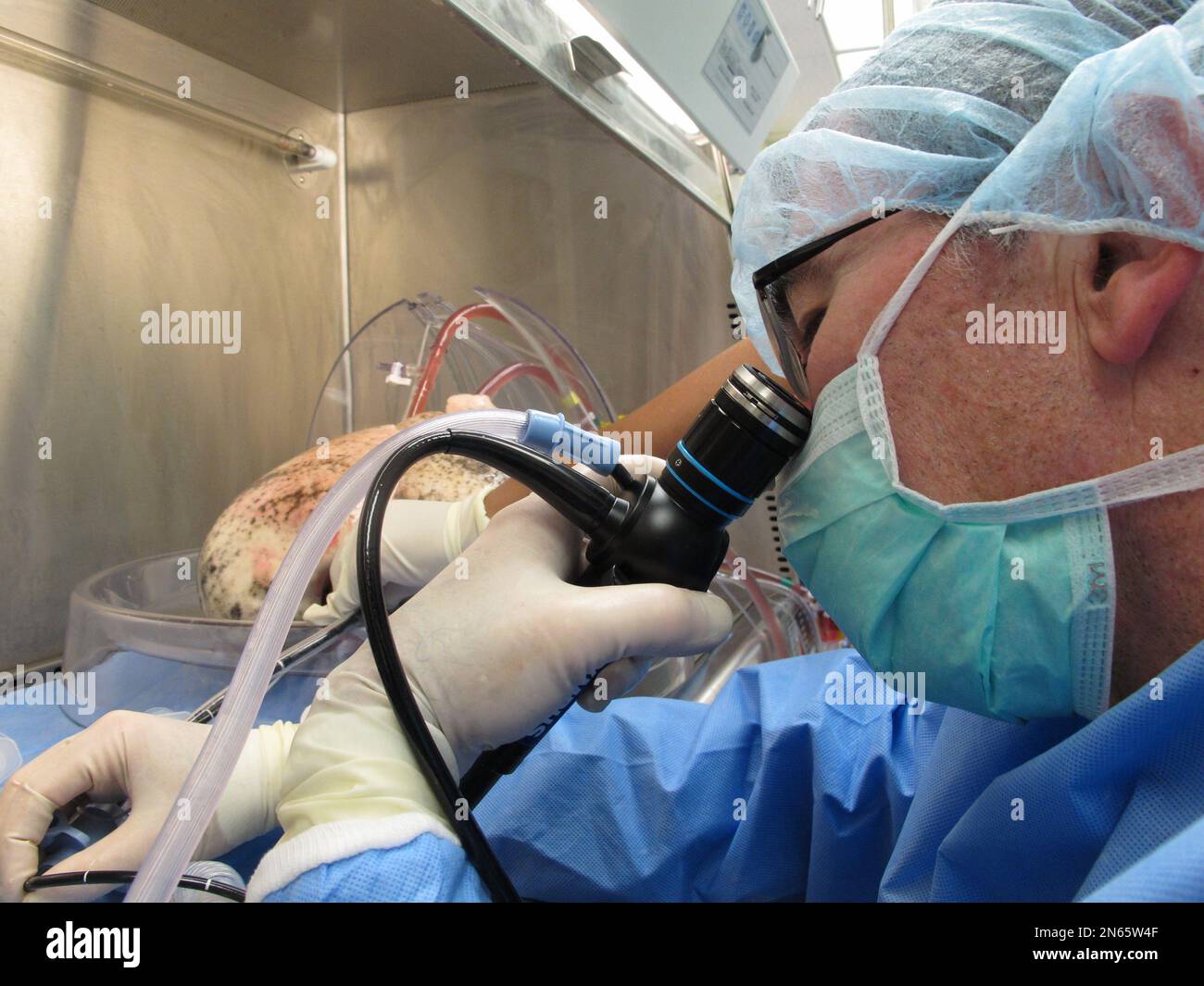 In this recent photo, Dr. Thomas Egan uses a bronchoscope to examine donated lungs in his lab at ...
