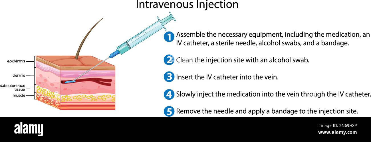 Intravenous Injection with explanation illustration Stock Vector Image ... Intravenous Injection with explanation illustration Stock Vector Image ...