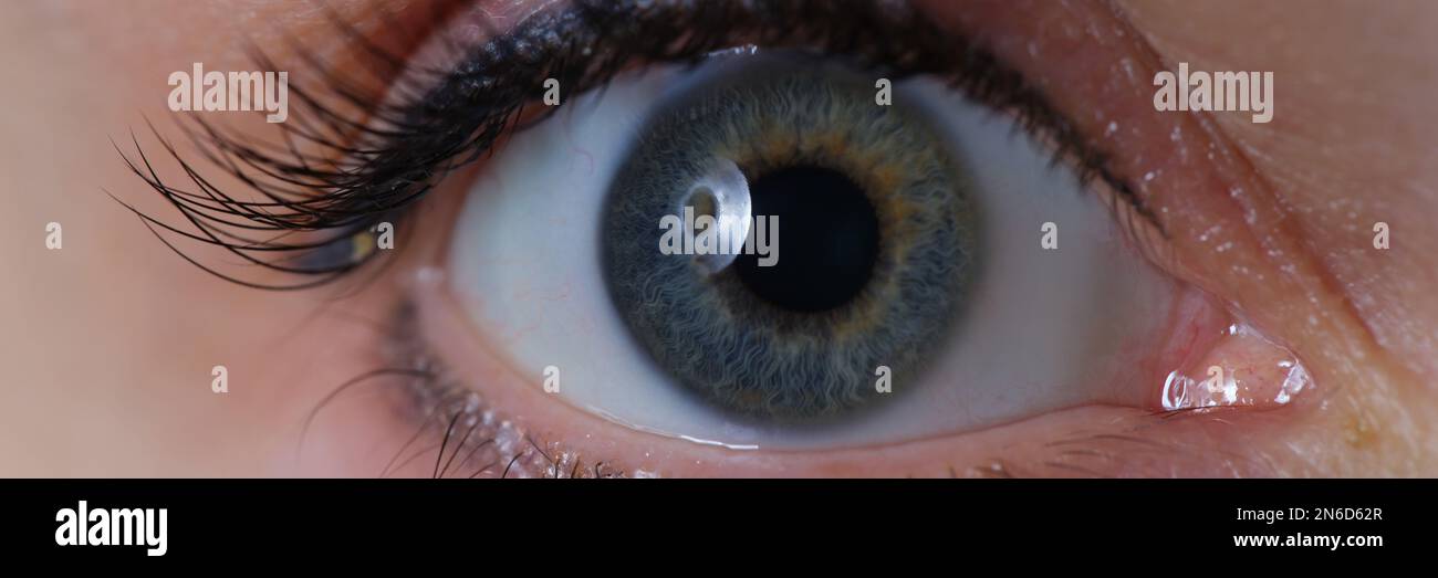 Wide open female eye with gray green pupil and a permanent arrow on ...