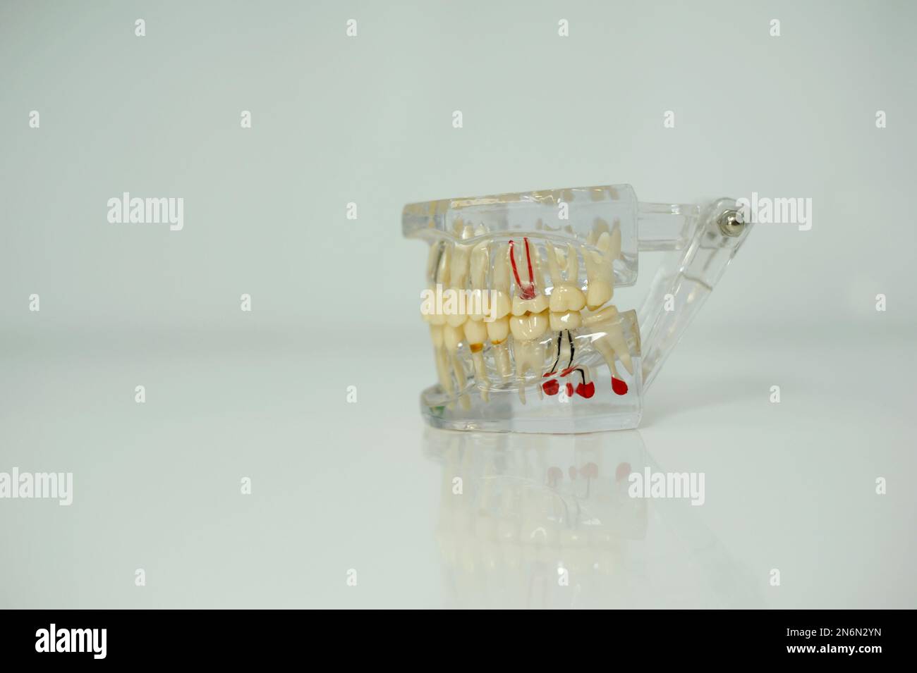 jaw model to demonstrate all dental diseases plastic teeth woman hand ...