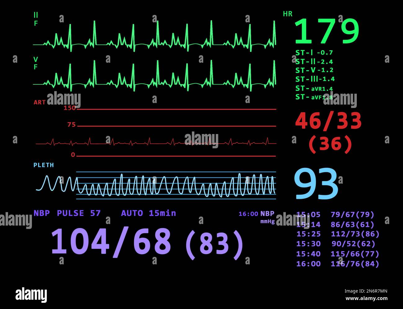 Monitor display of heartbeat hi-res stock photography and images - Alamy