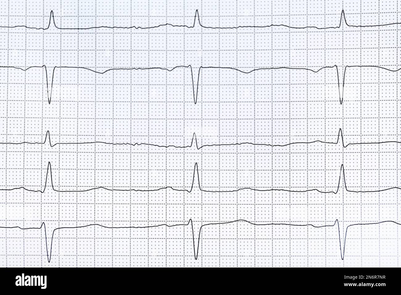 Cardiogram report as background, top view. Heart diagnosis Stock Photo ...