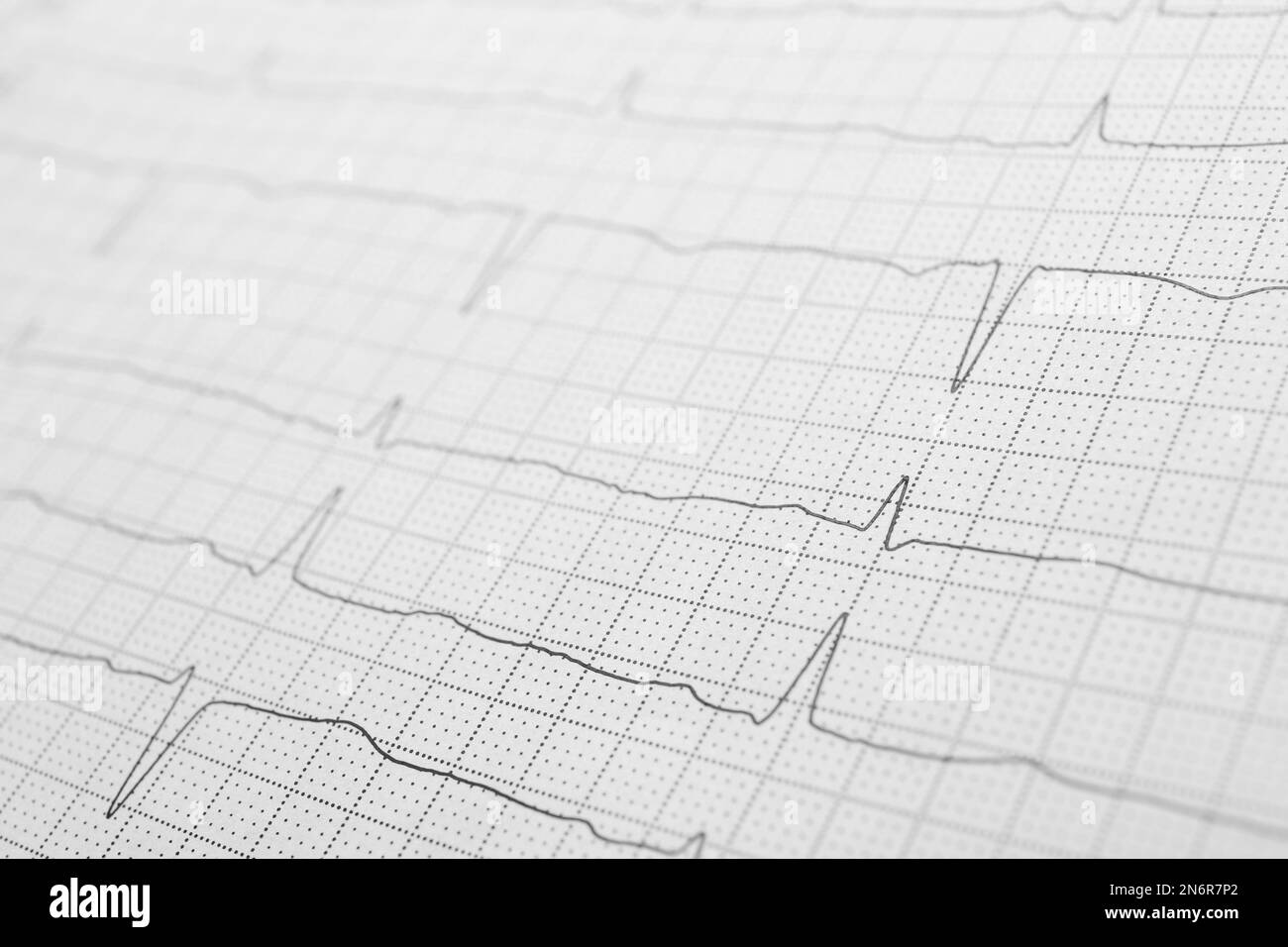 Cardiogram report as background, closeup view. Heart diagnosis Stock ...