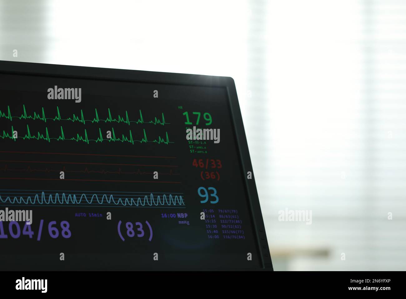 Monitor with cardiogram in hospital, focus on screen. Space for text ...