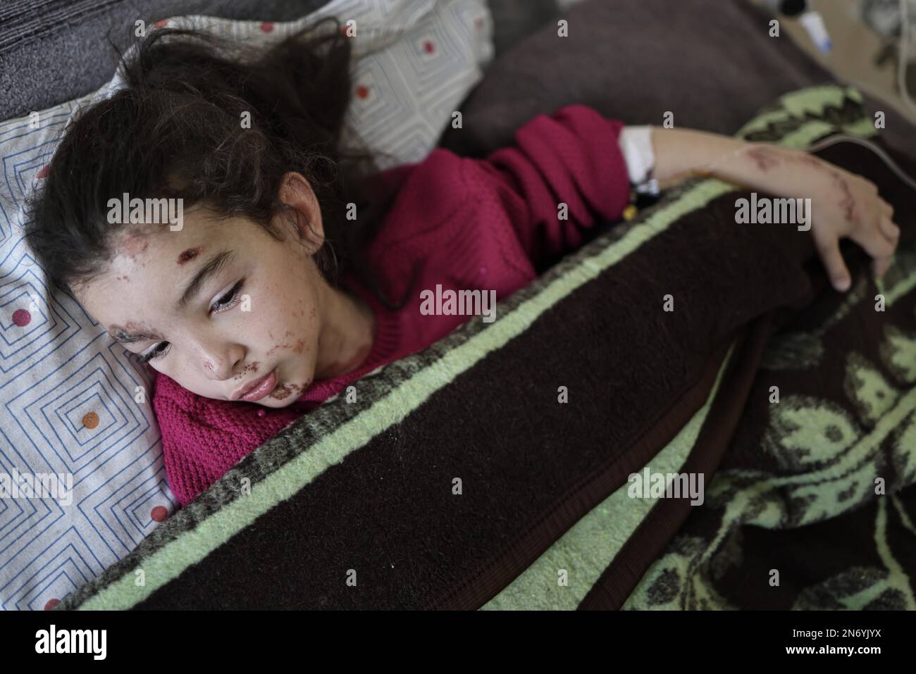 Idlib, Syria. 10th Feb, 2023. Rama Al-Ahmed, 10, a survivor of the ...