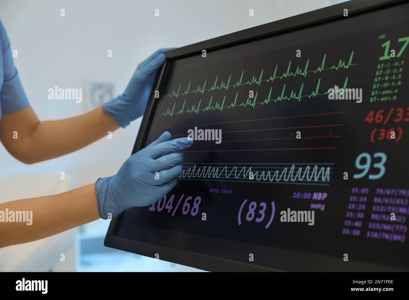 Black nurse heart rate monitor hi-res stock photography and images - Alamy
