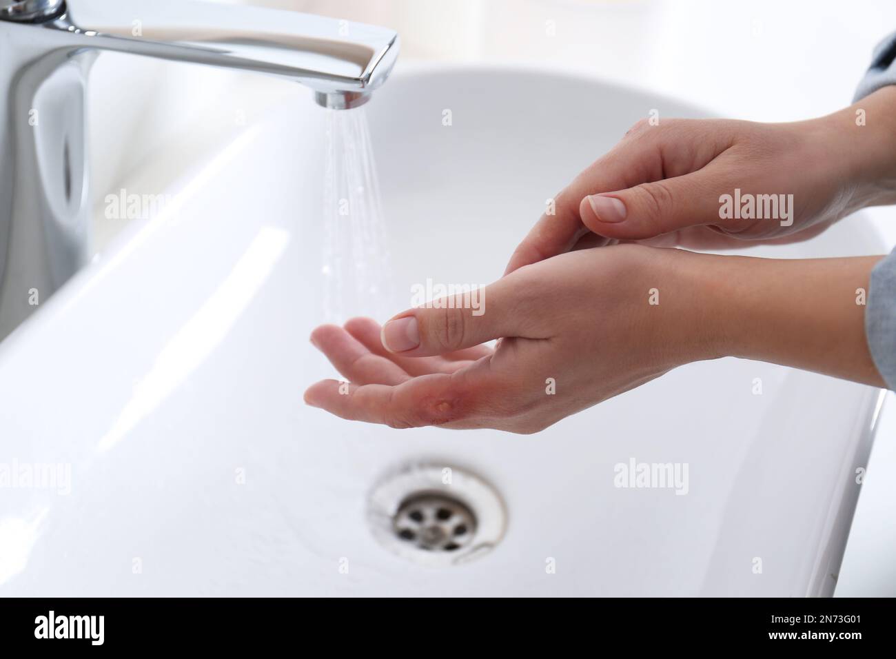 Woman putting burned hand under running cold water indoors, closeup ...