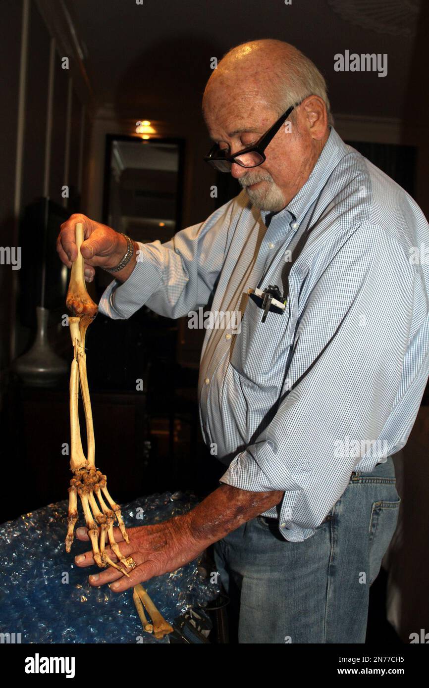 In this photo taken Sunday, June 30, 2013, Dr. Sam Axelrad displays in ...