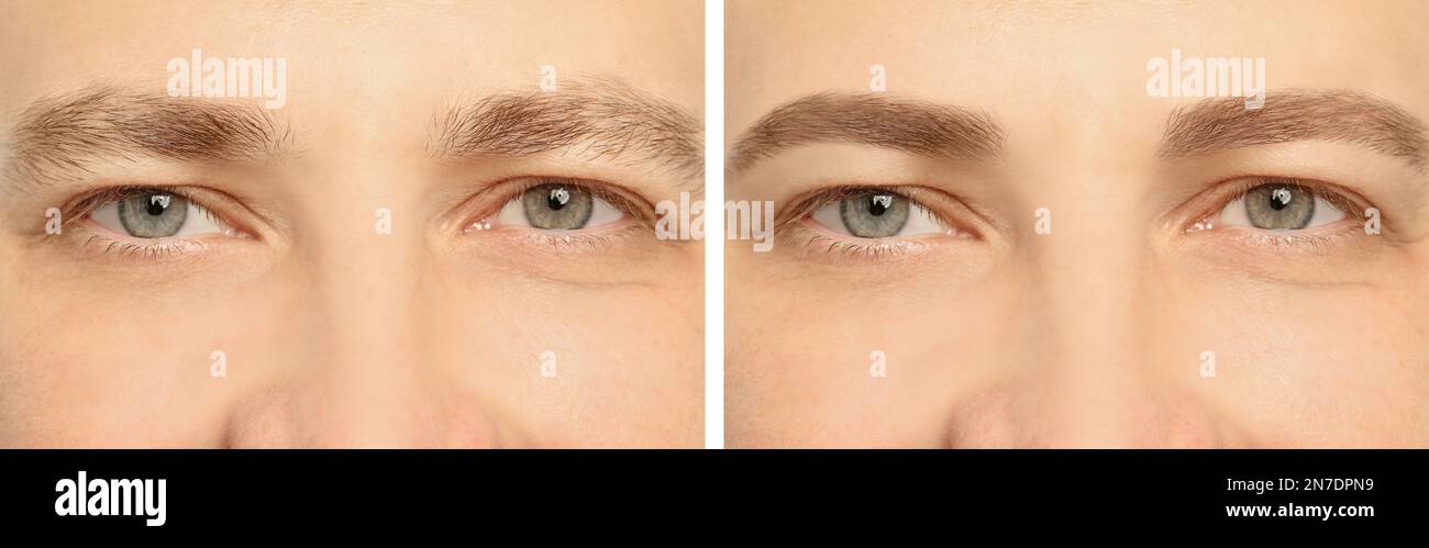 Collage with photos of man before and after eyebrow modeling, closeup ...
