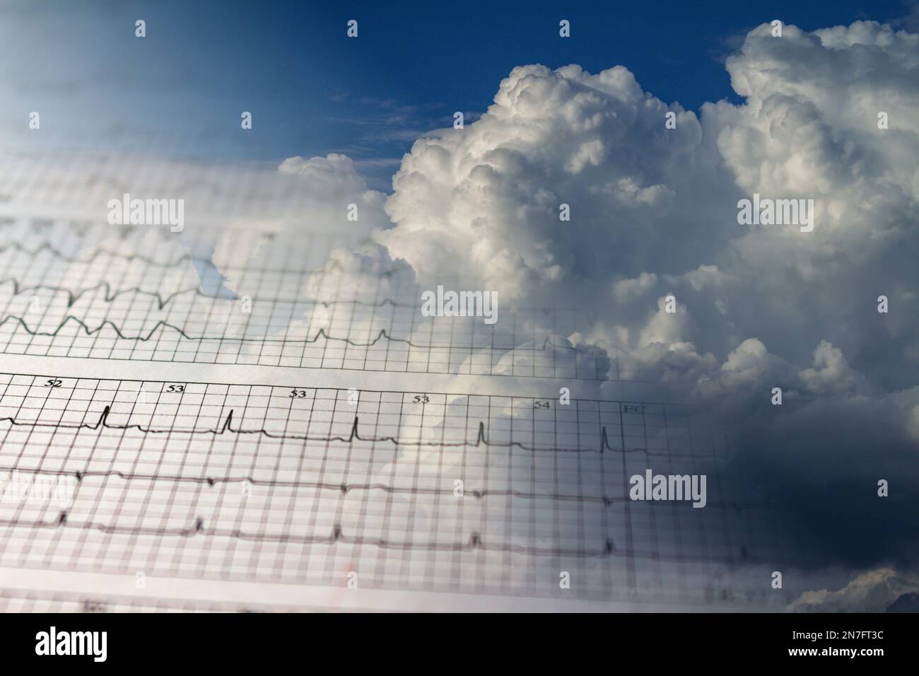 Electrocardiogram tracing that ends in clouds. Concept of death from ...