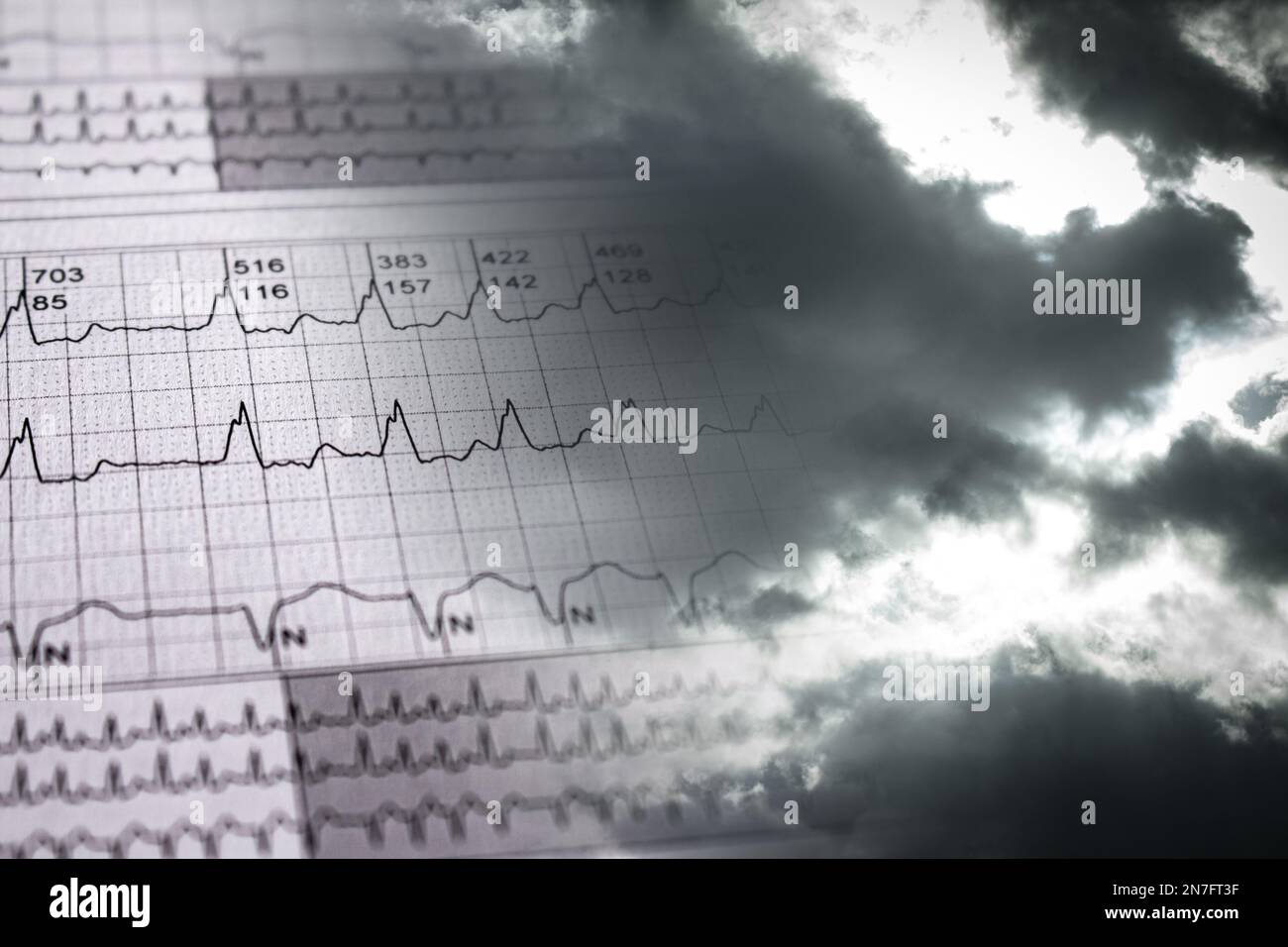 Electrocardiogram tracing that ends in clouds. Concept of death from ...