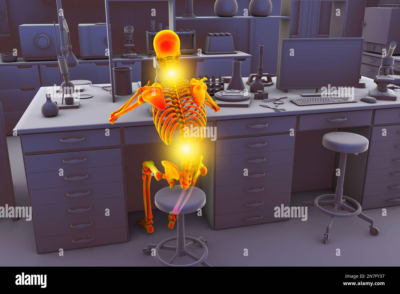 Musculoskeletal disorders in lab workers, illustration Stock Photo - Alamy