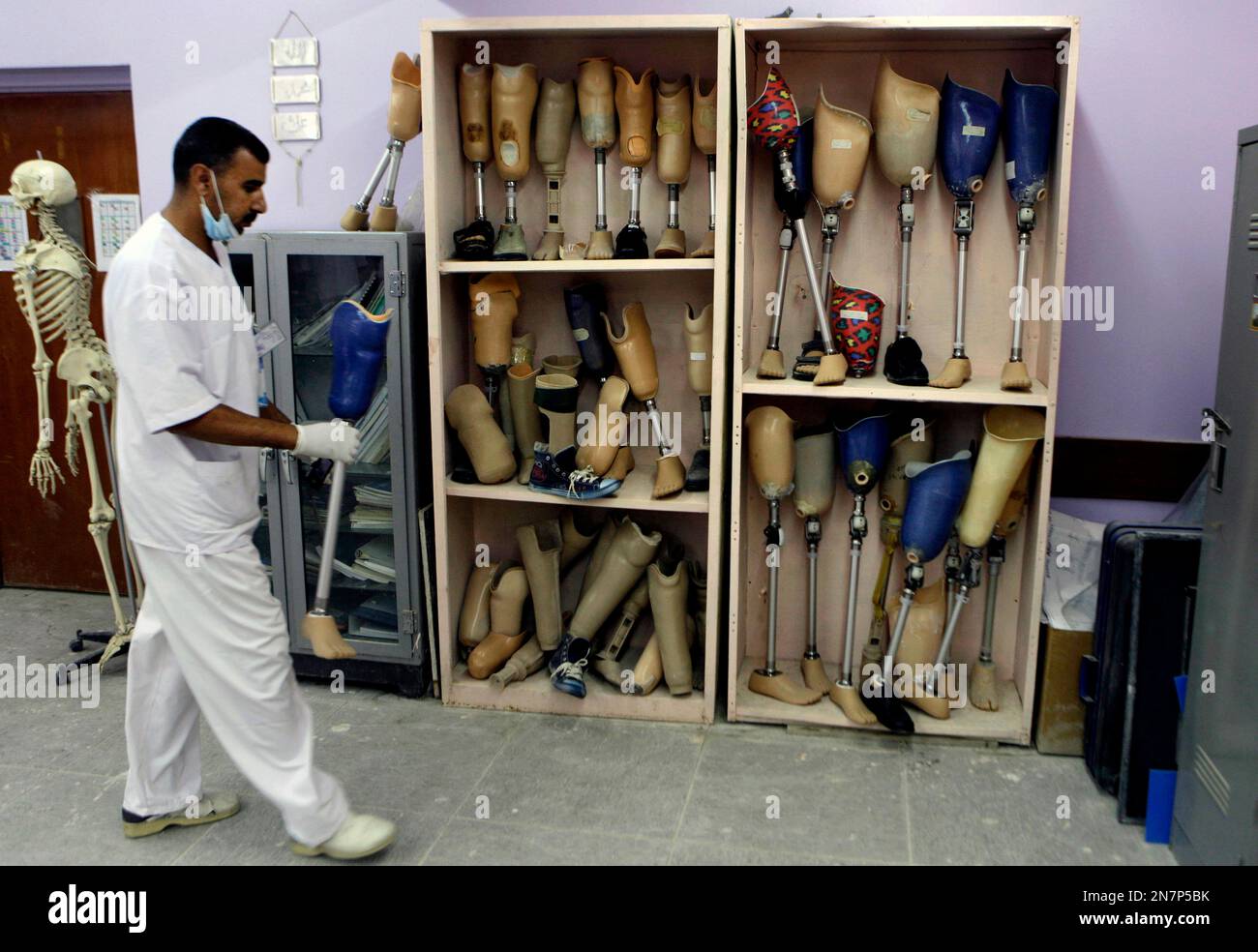 An orthotist looks at prosthetic legs at the prosthetic limbs hospital ...