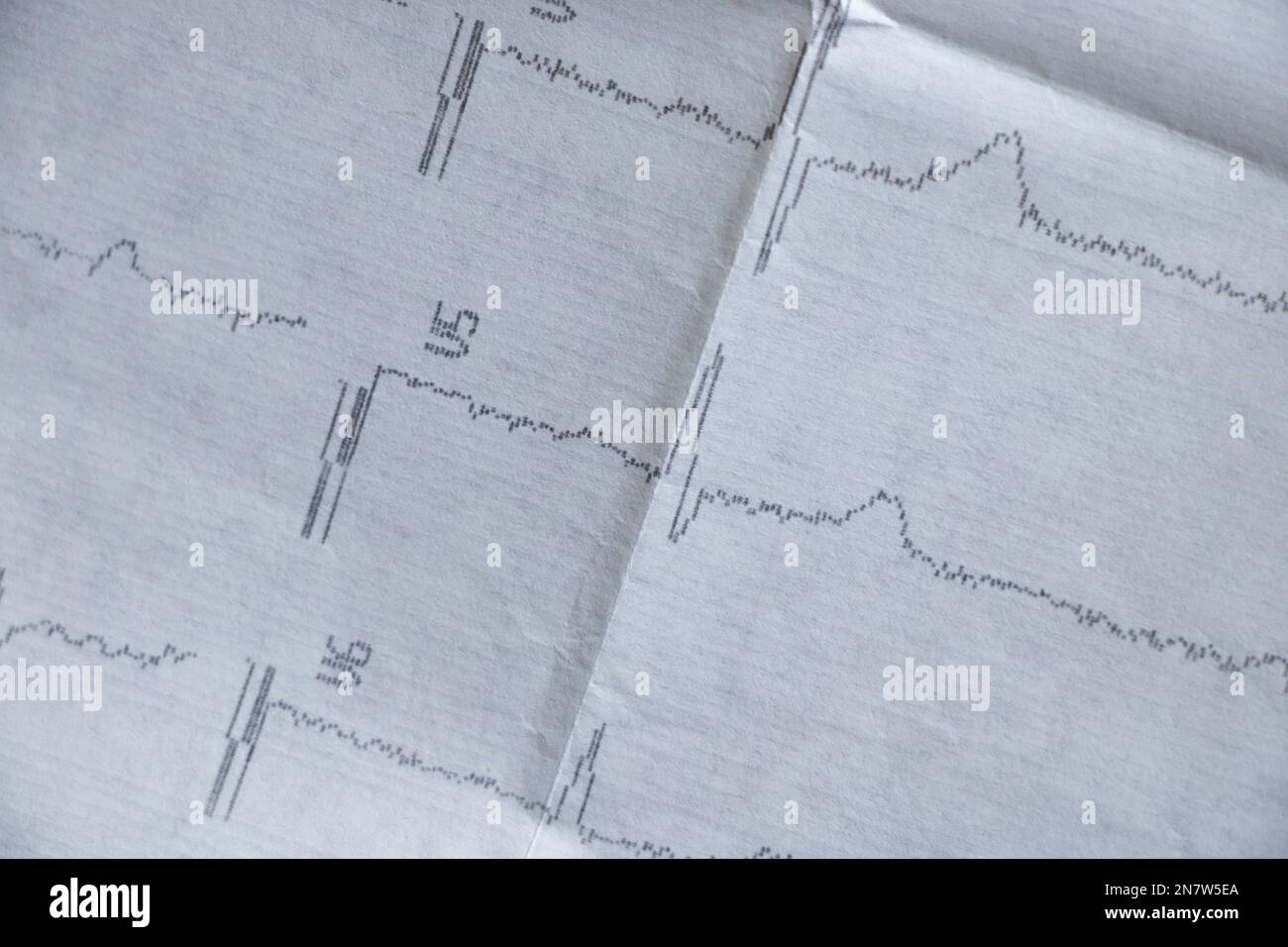 cardiogram on old paper as background macro photo Stock Photo - Alamy