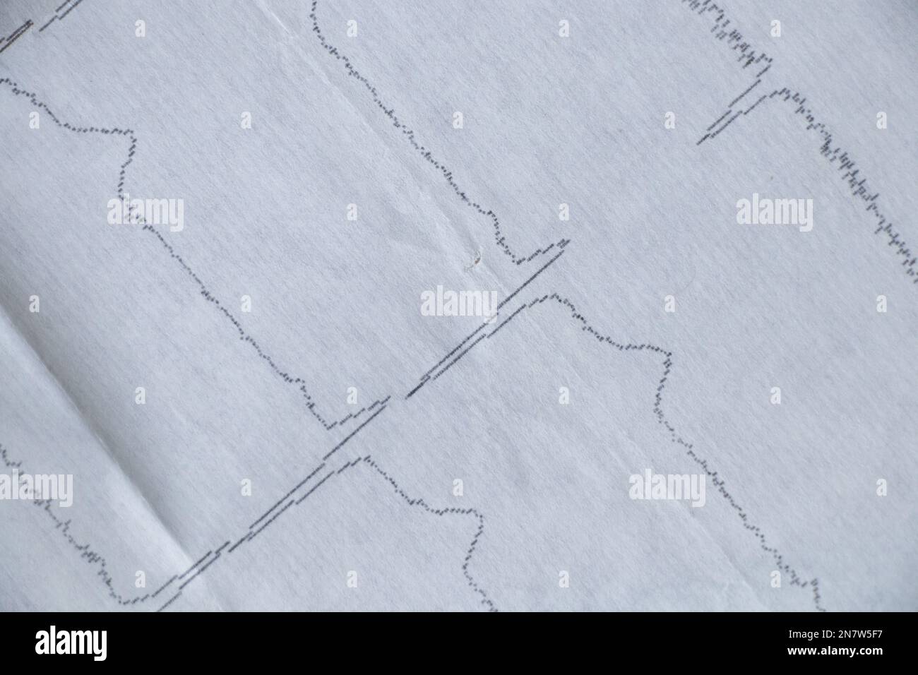 Heart diagram old hi-res stock photography and images - Alamy