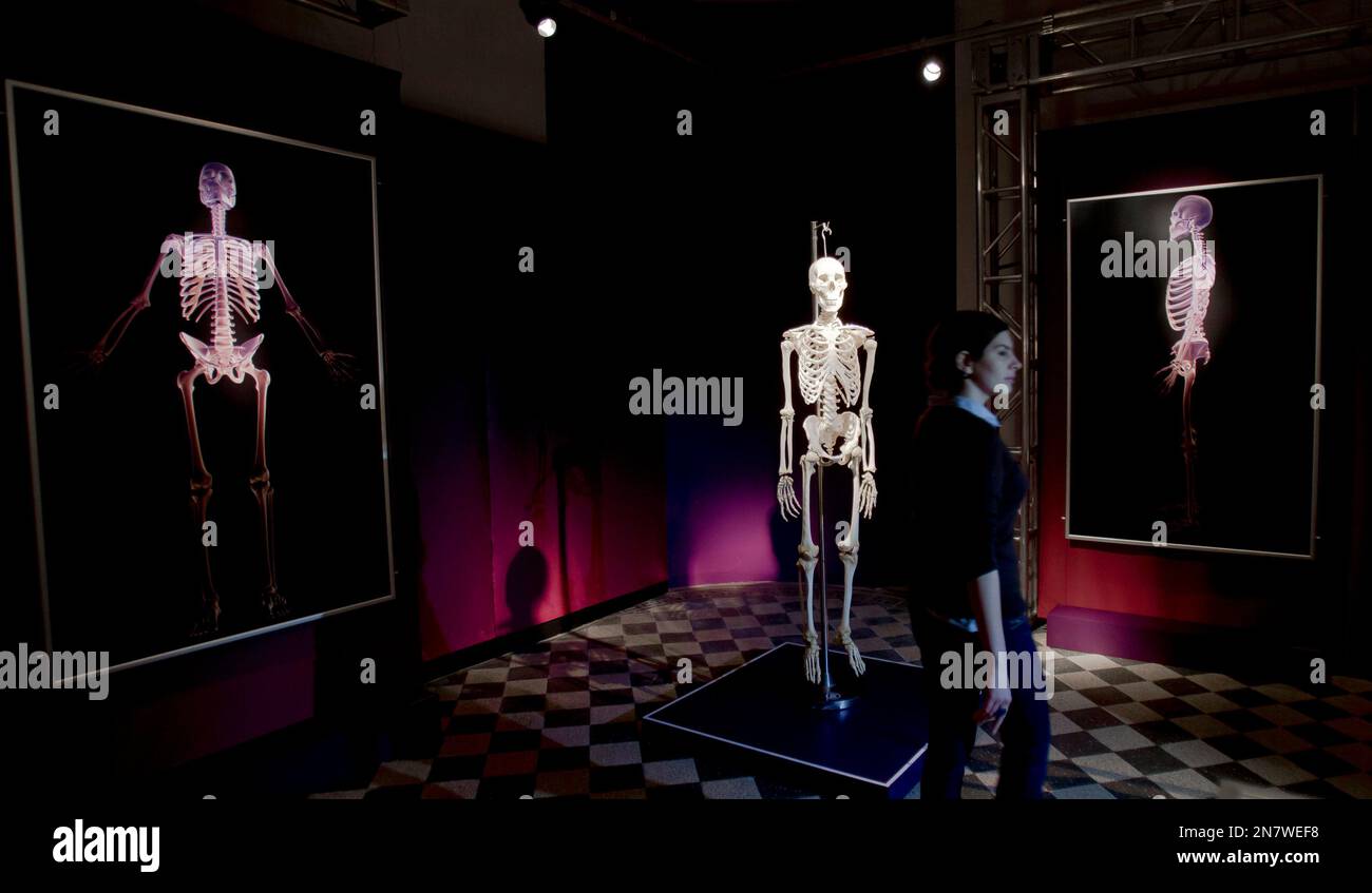 A woman passes by exhibits in The Human Body exhibition during a media ...