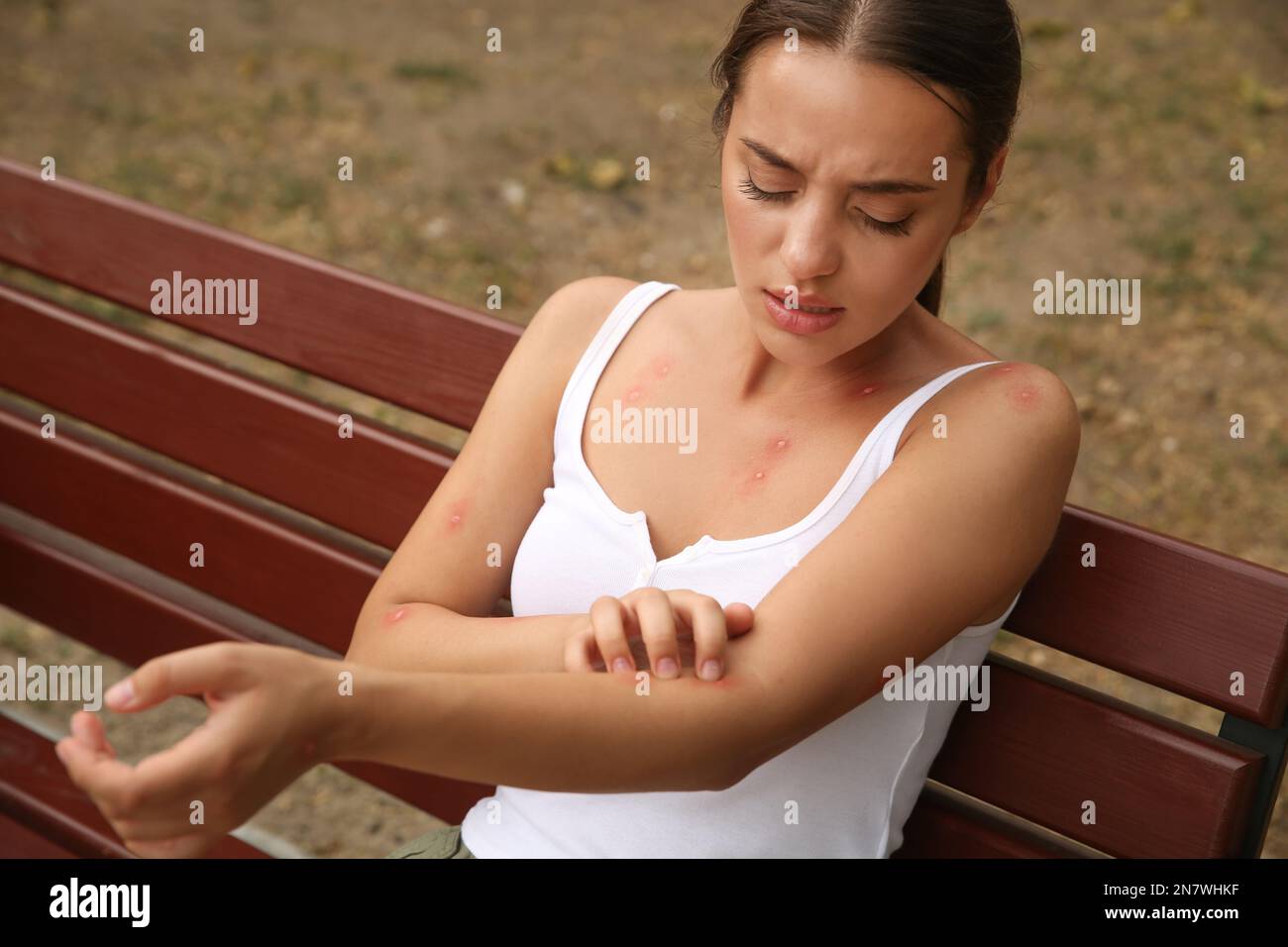 Woman scratching arm with insect bite outdoors Stock Photo - Alamy