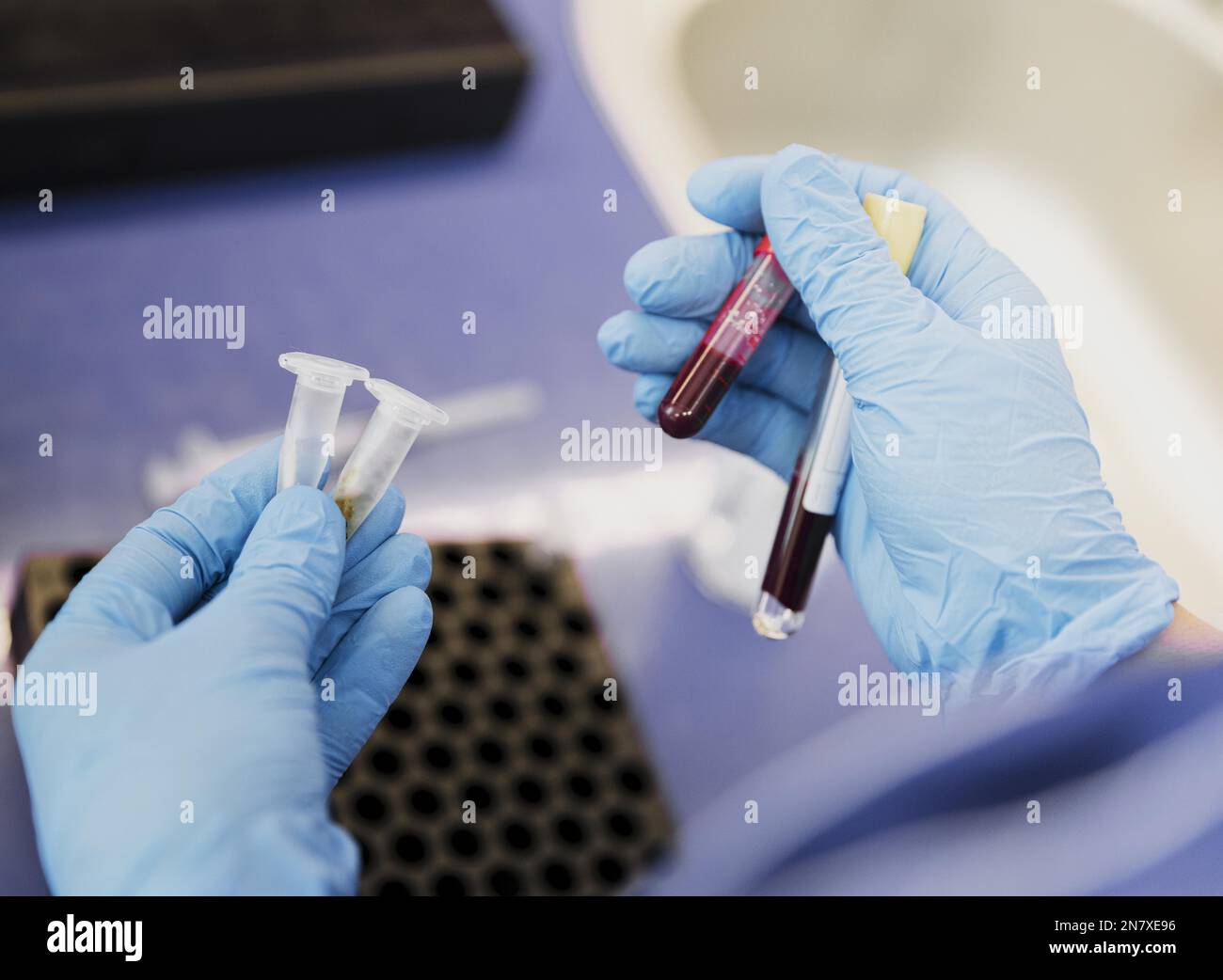 Capillary tube finger hi-res stock photography and images - Alamy
