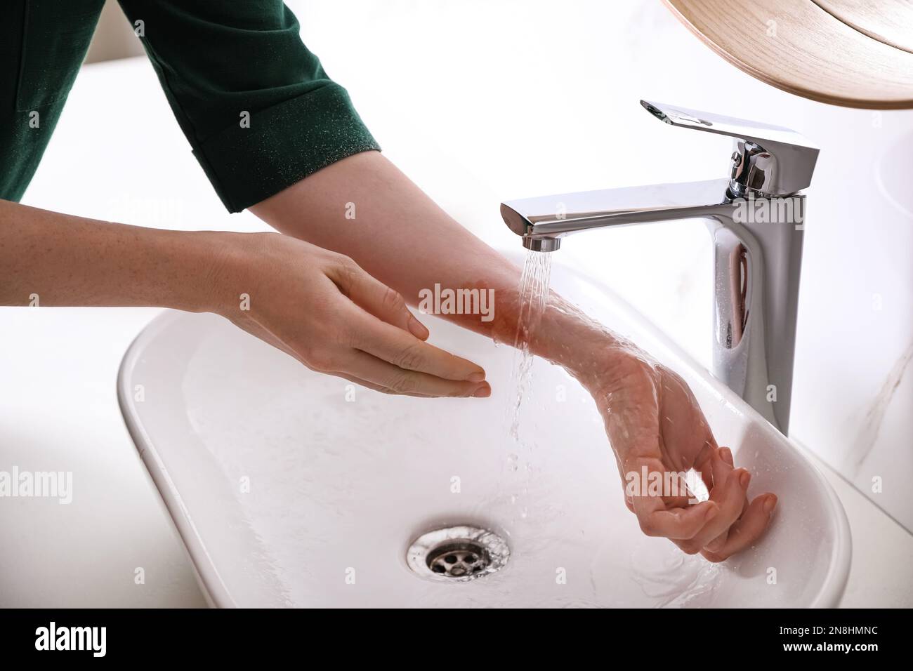 Woman putting burned hand hi-res stock photography and images - Alamy