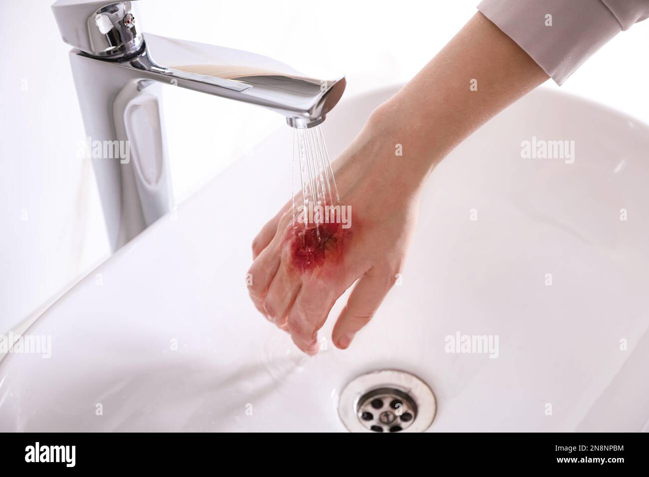 Burn skin cold water hi-res stock photography and images - Alamy