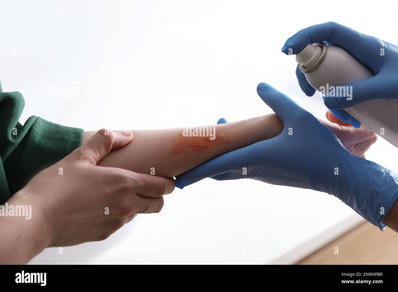 Applying burn spray onto injured skin, closeup Stock Photo - Alamy