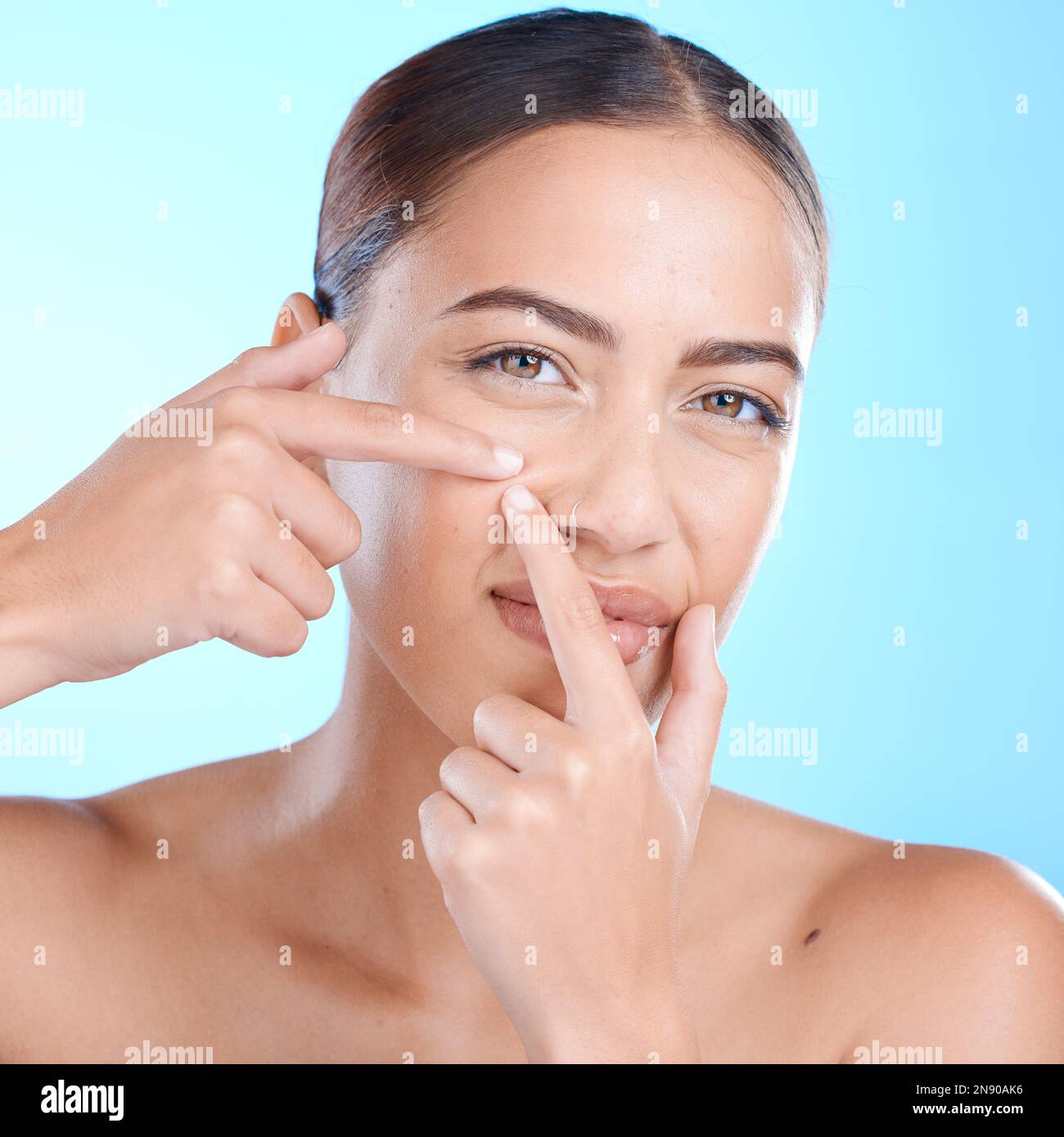 Skincare, acne and portrait of woman with pimple on blue background for ...