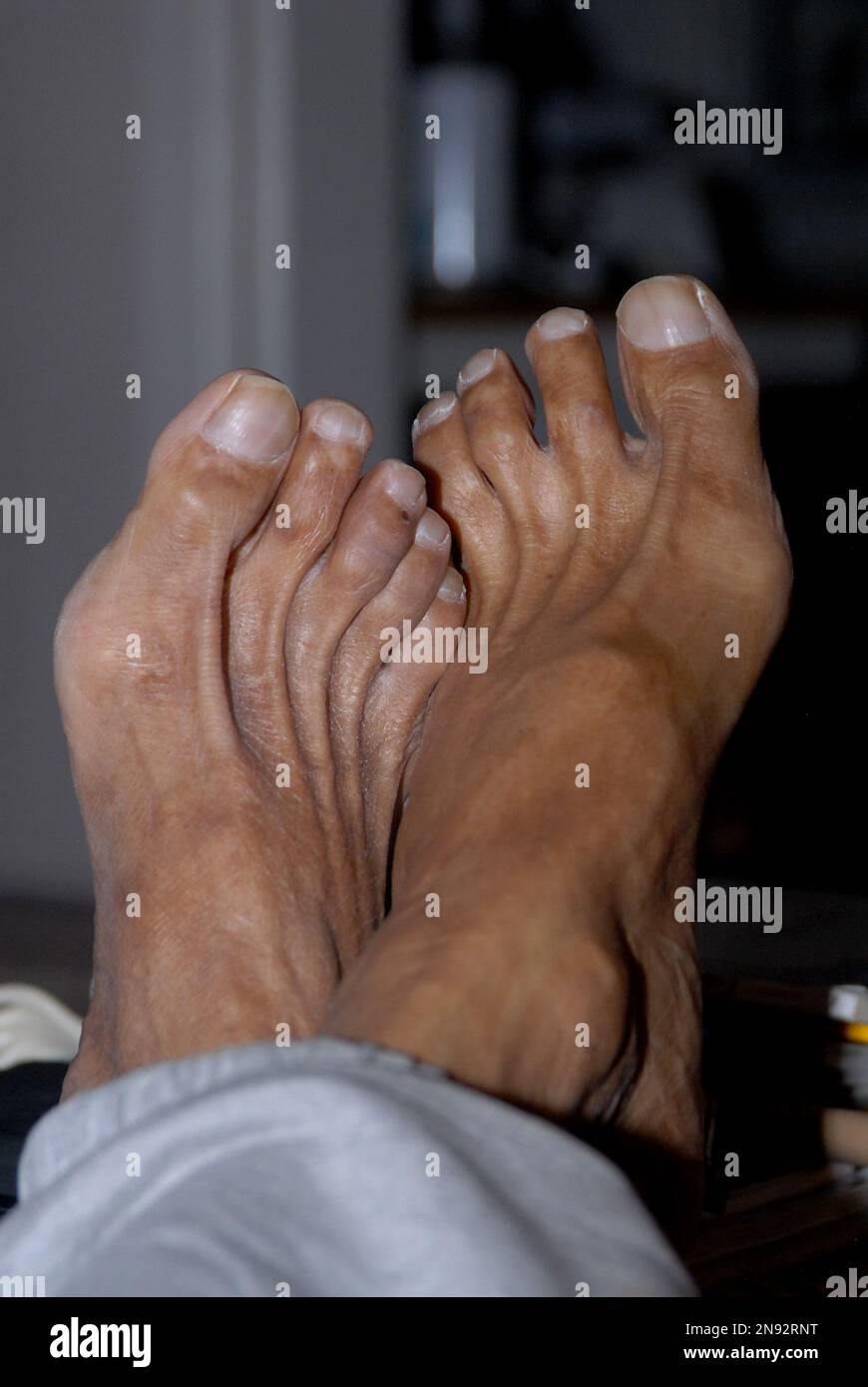12 toes hi-res stock photography and images - Alamy